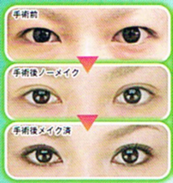 How to Glue Your Eyelids – Only In Japan